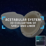 Acetabular System - 3D Evaluation of Shell and Liner | EDMIS